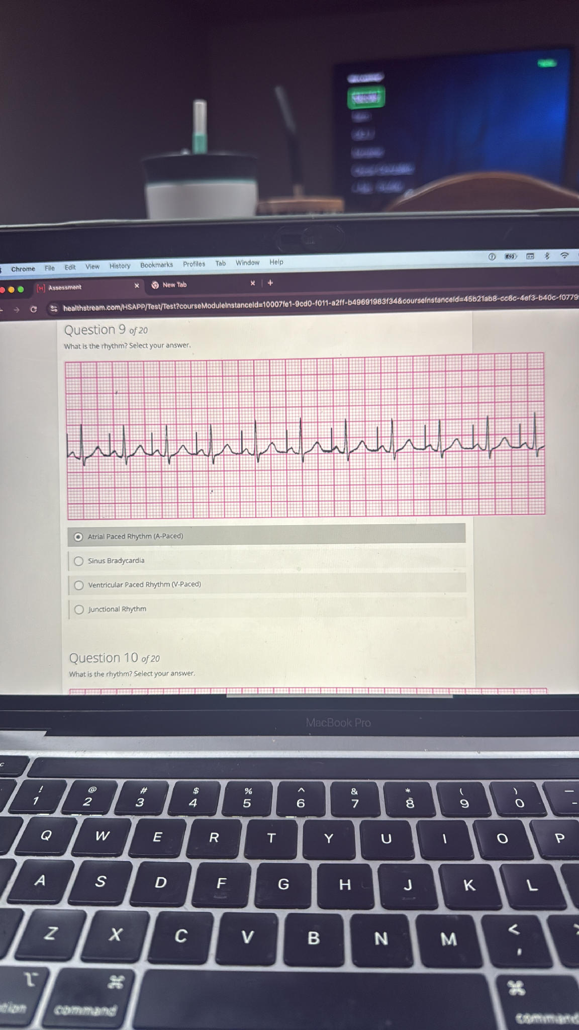 Question 9 of 20 What is the rhythm? Select | StudyX