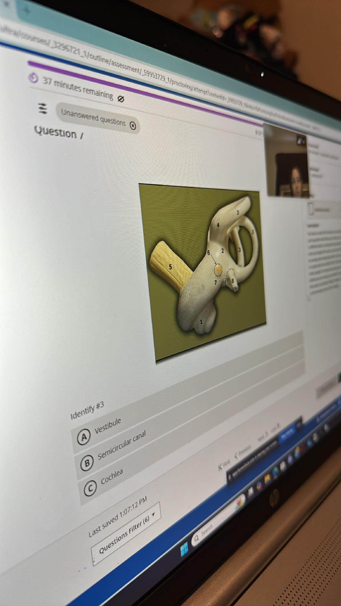 Identify #3 A) Vestibule B) Semicircular | StudyX