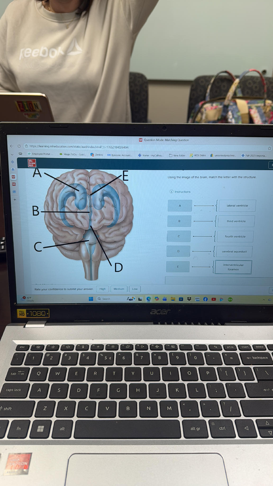 Using the image of the brain, match the | StudyX