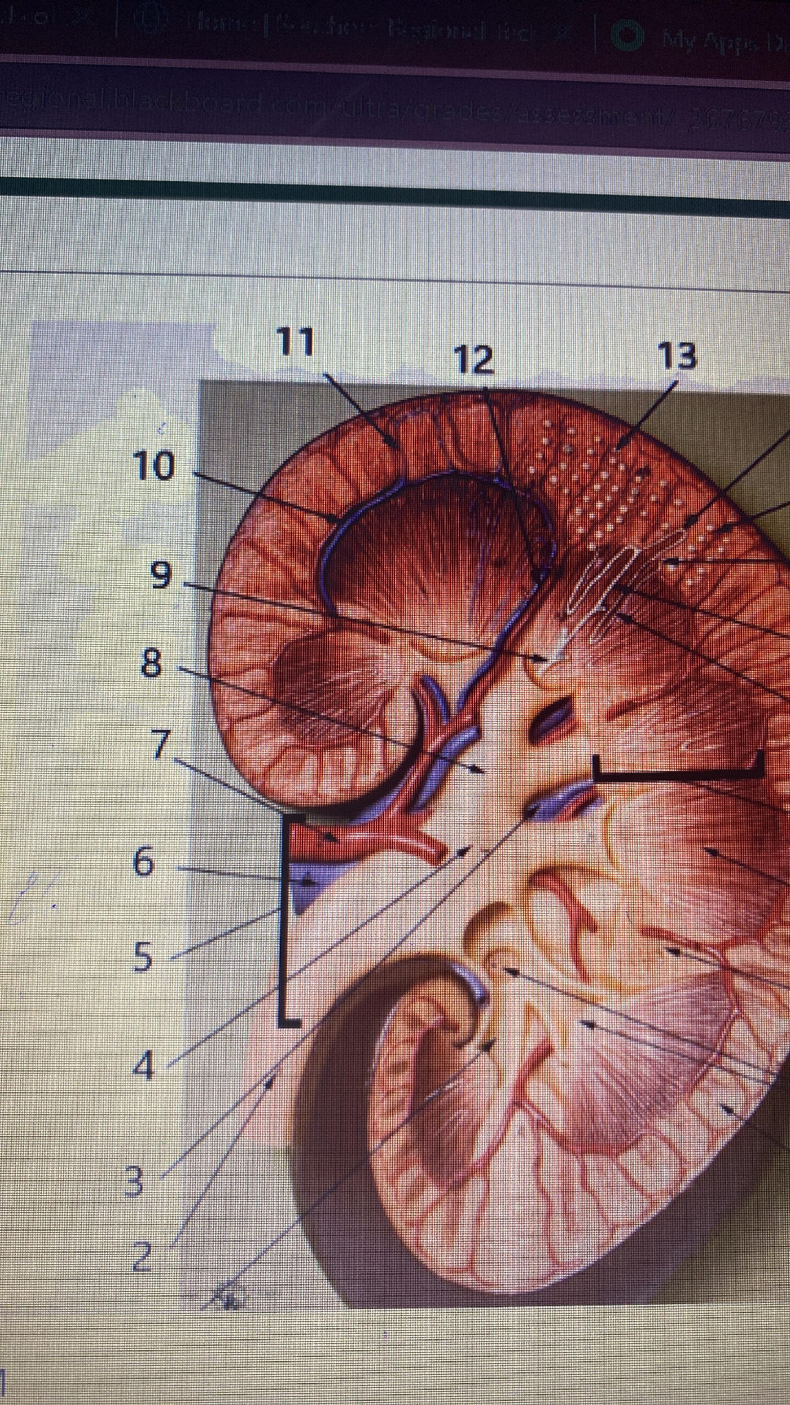 The image shows a diagram of a kidney | StudyX
