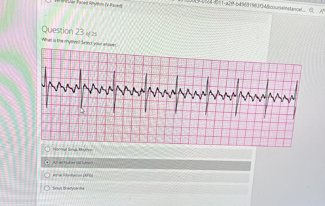 Question 23 of 25 What is the rhythm? Select | StudyX