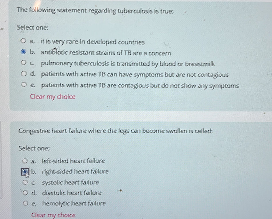 Congestive heart failure where the legs can | StudyX