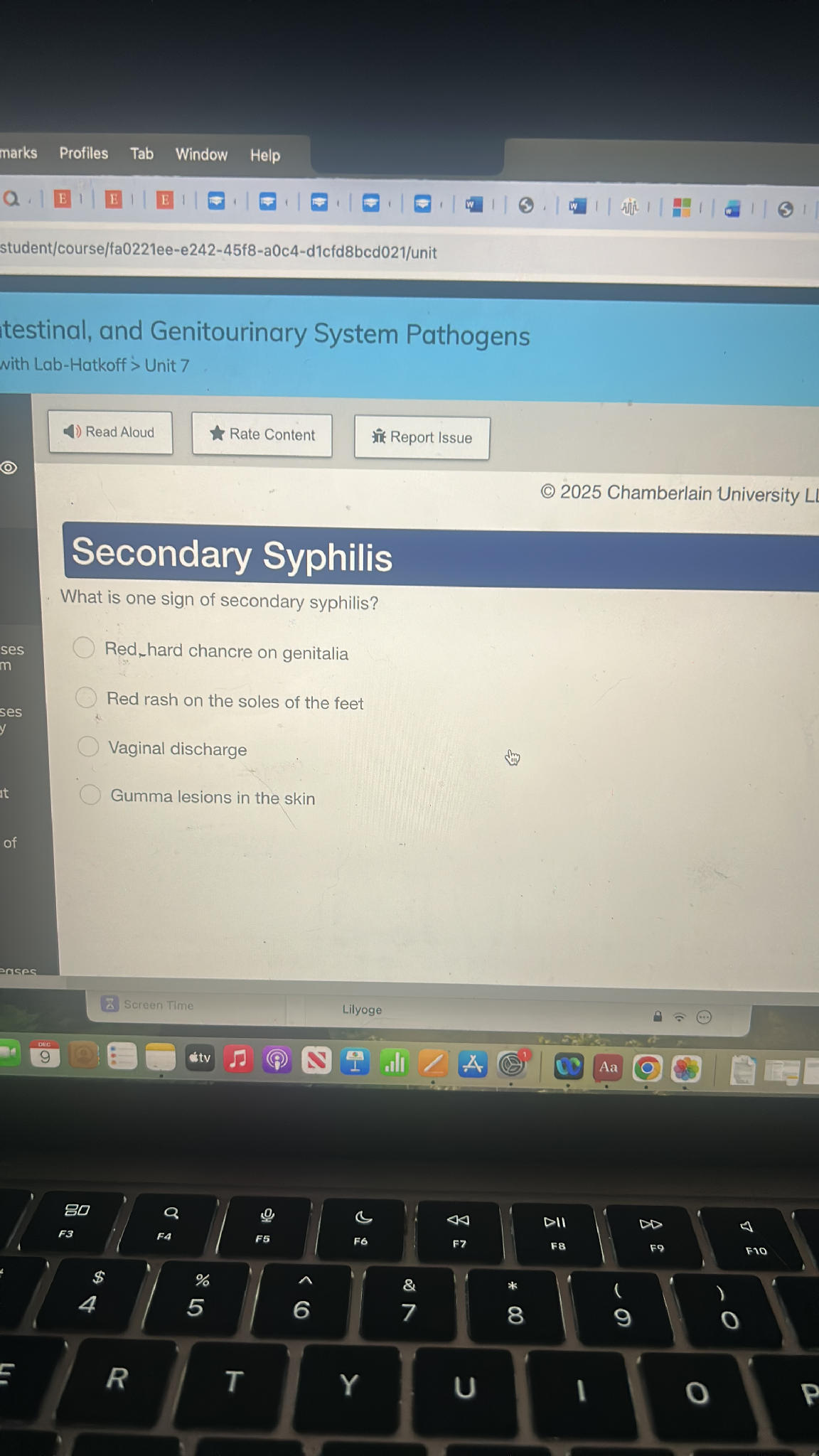 Secondary Syphilis What is one sign of | StudyX