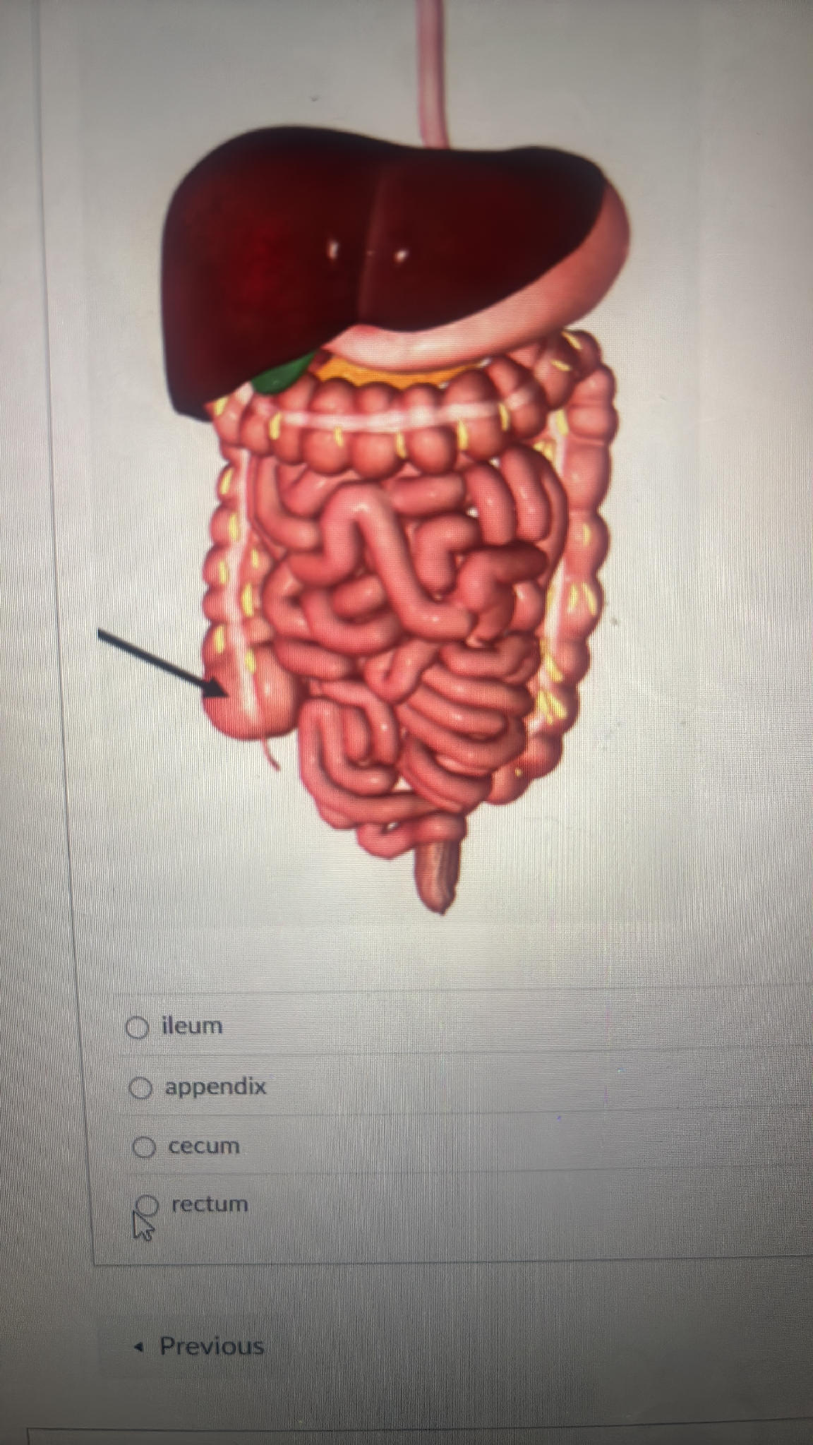 Identify the structure indicated by the | StudyX