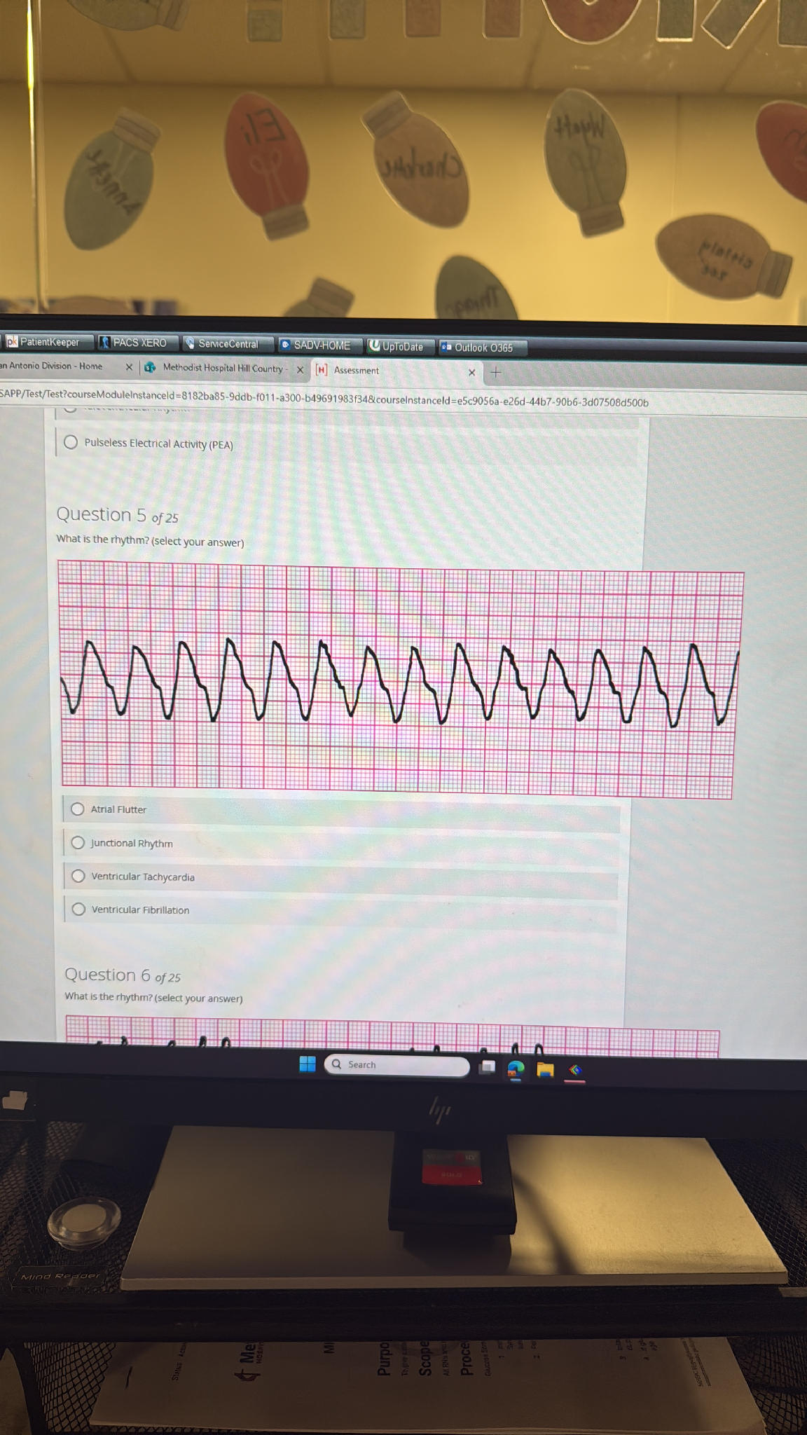 Question 5 of 25 What is the rhythm? | StudyX