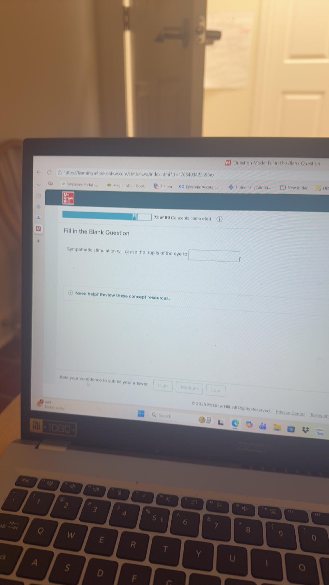 Sympathetic stimulation will cause the | StudyX