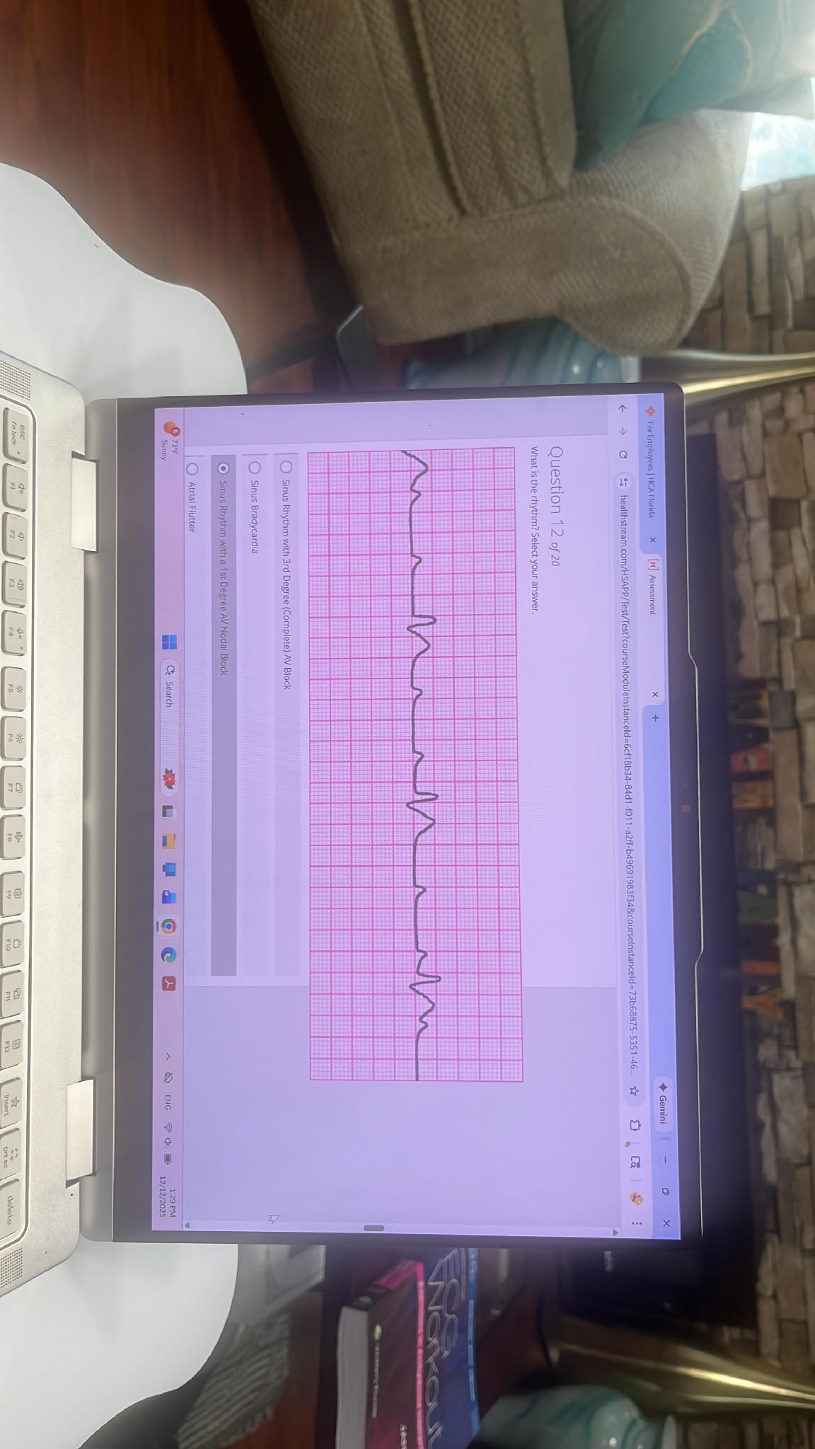 Question 12 of 20 What is the rhythm? Select | StudyX