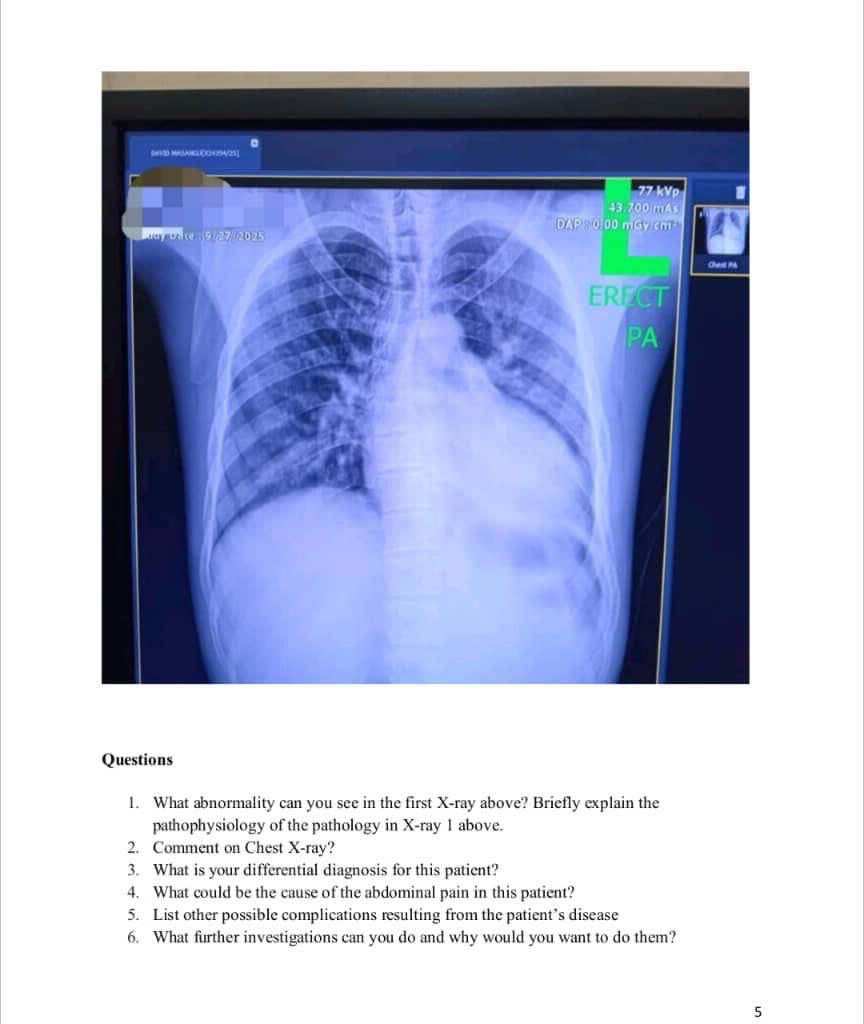 Image shows a Chest X-ray. Questions 1. | StudyX