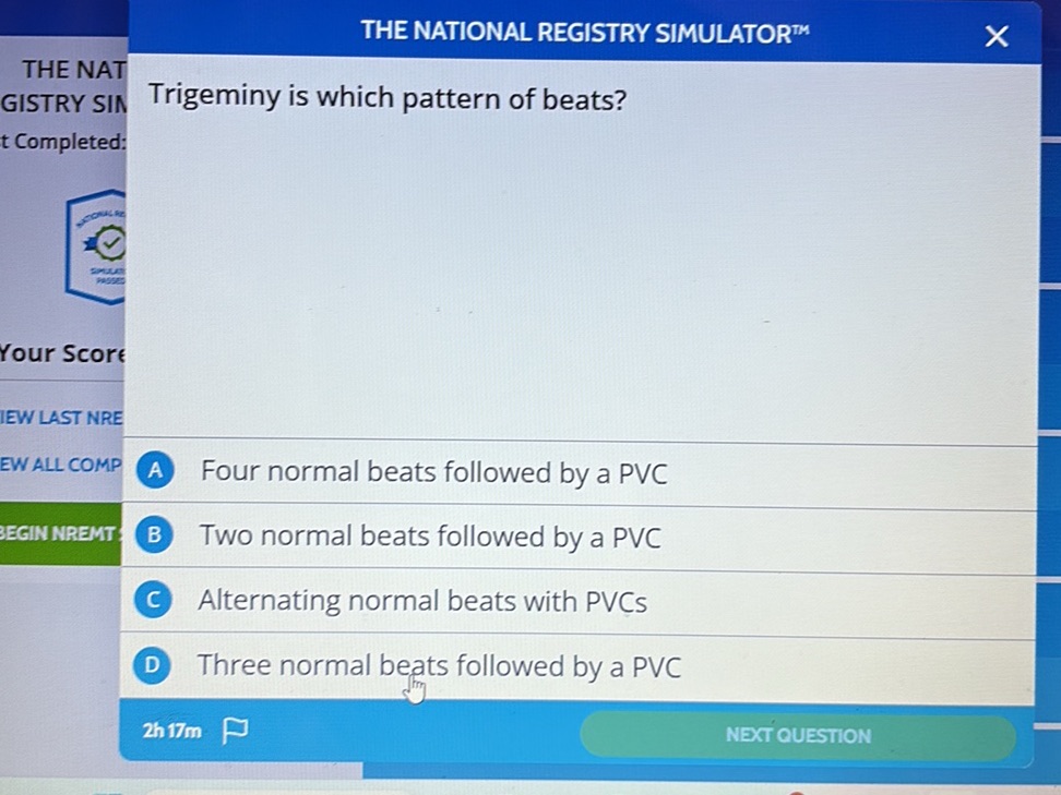 Trigeminy is which pattern of beats? A Four | StudyX