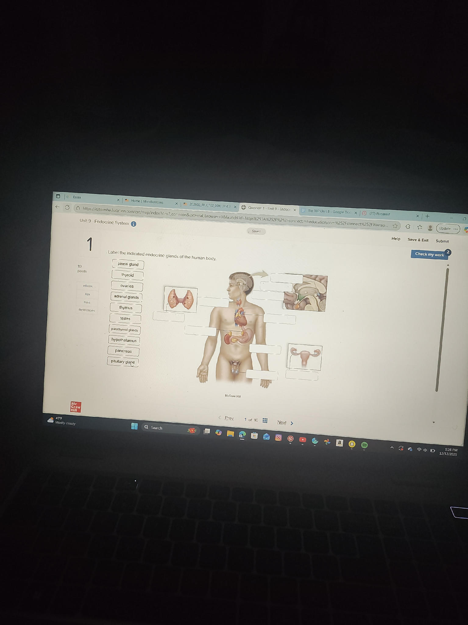 Label the indicated endocrine glands of the | StudyX