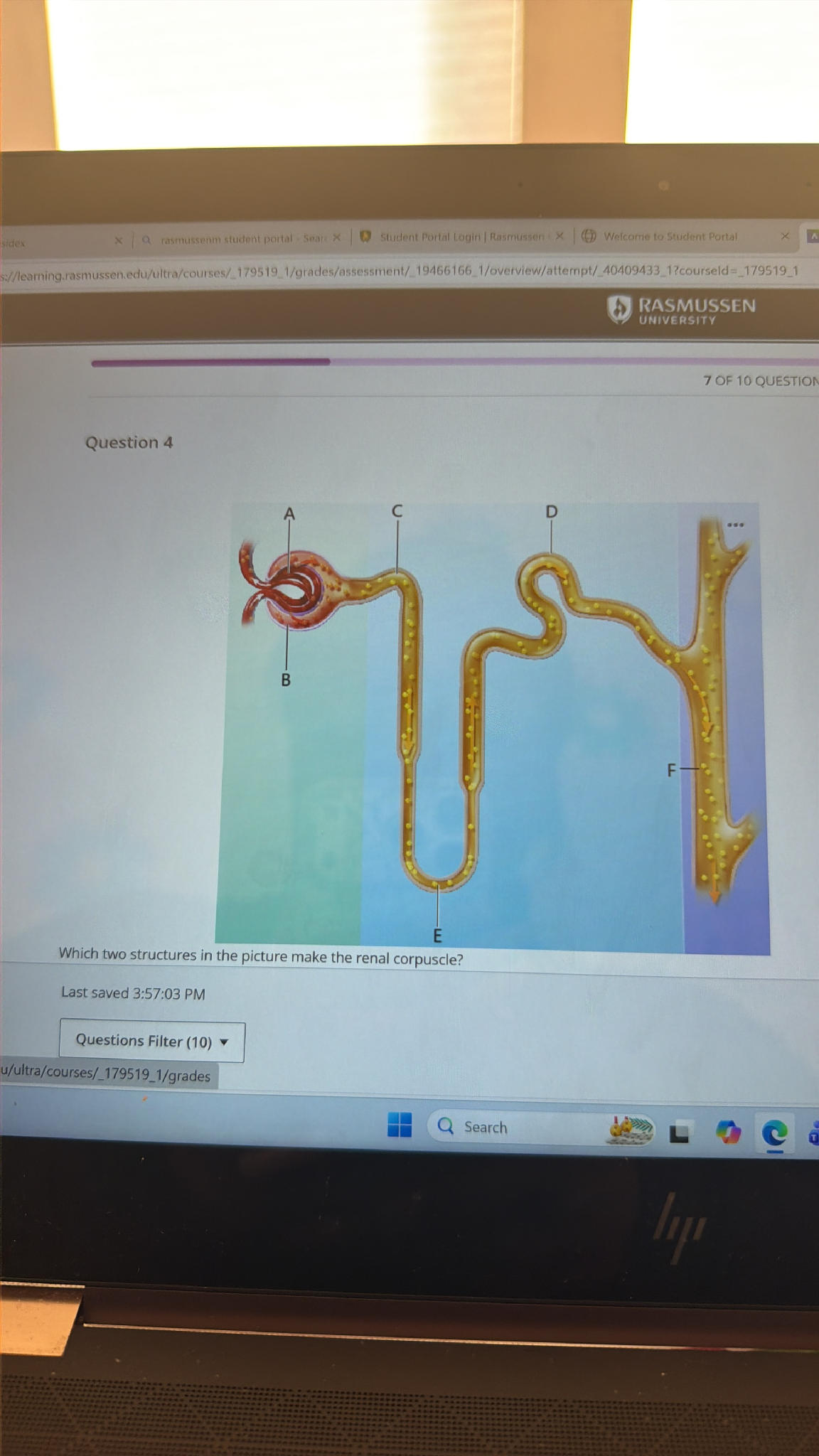 Question 4 [Diagram of a nephron with parts | StudyX