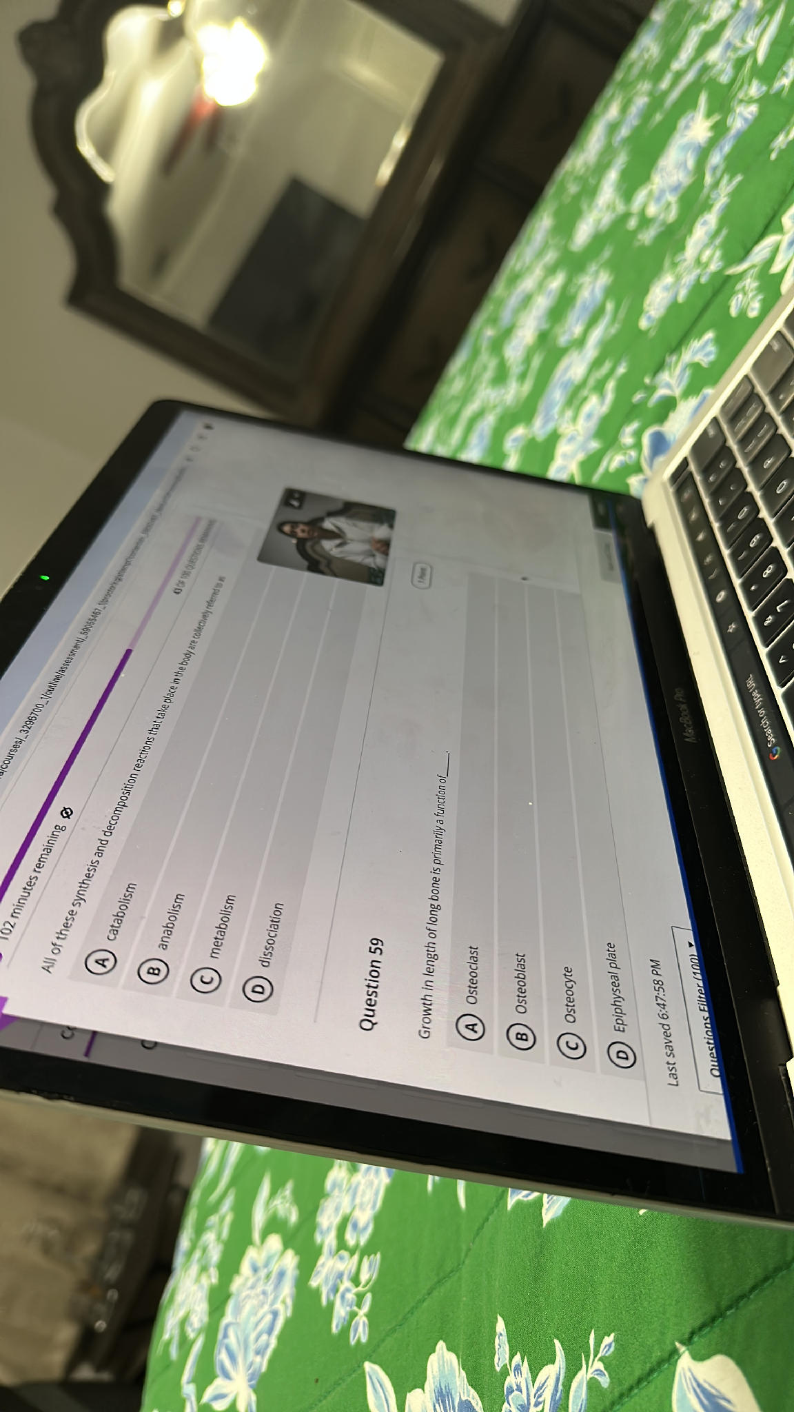 Question 59 Growth in length of long bone is | StudyX