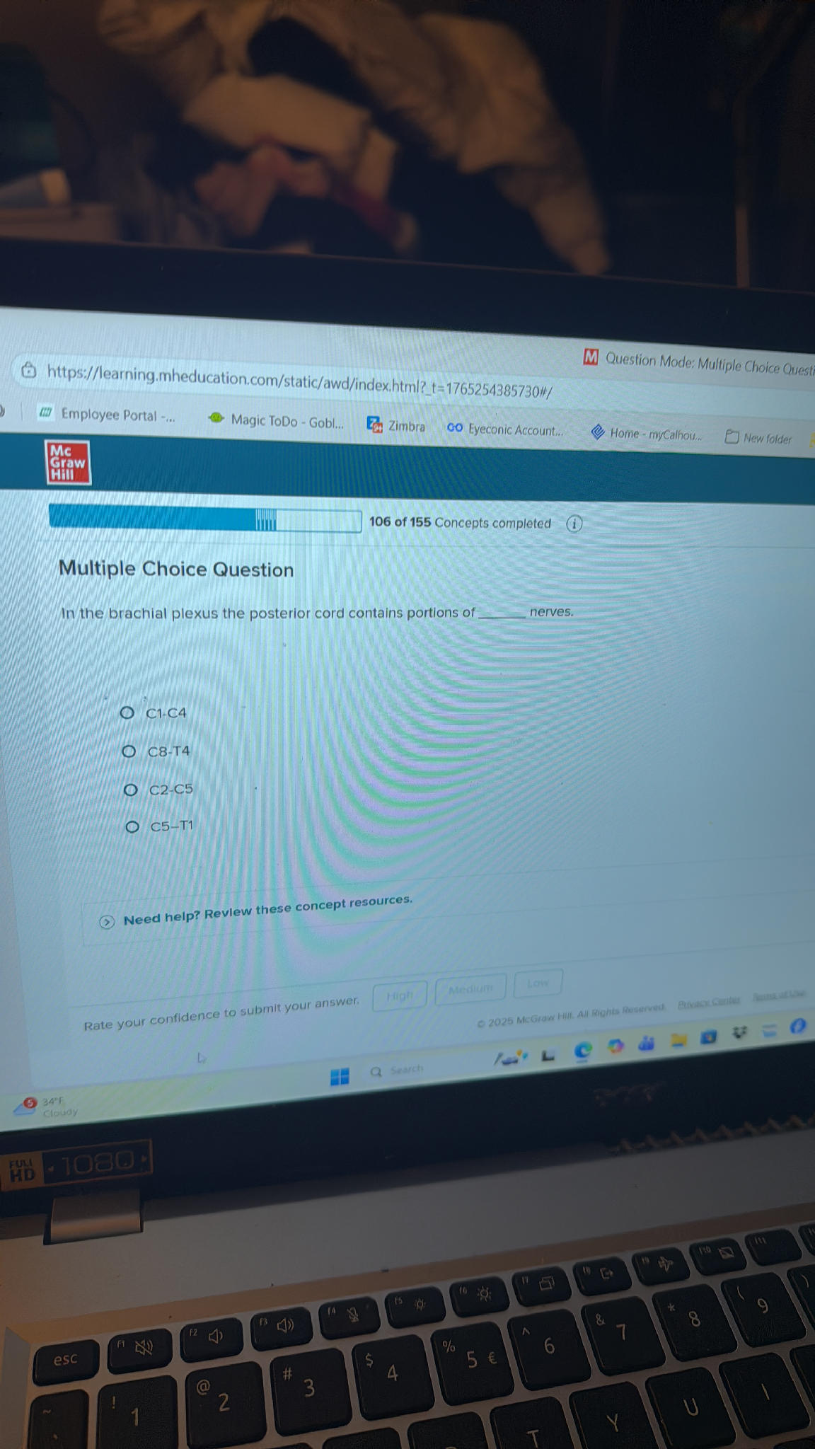 Multiple Choice Question In the brachial | StudyX