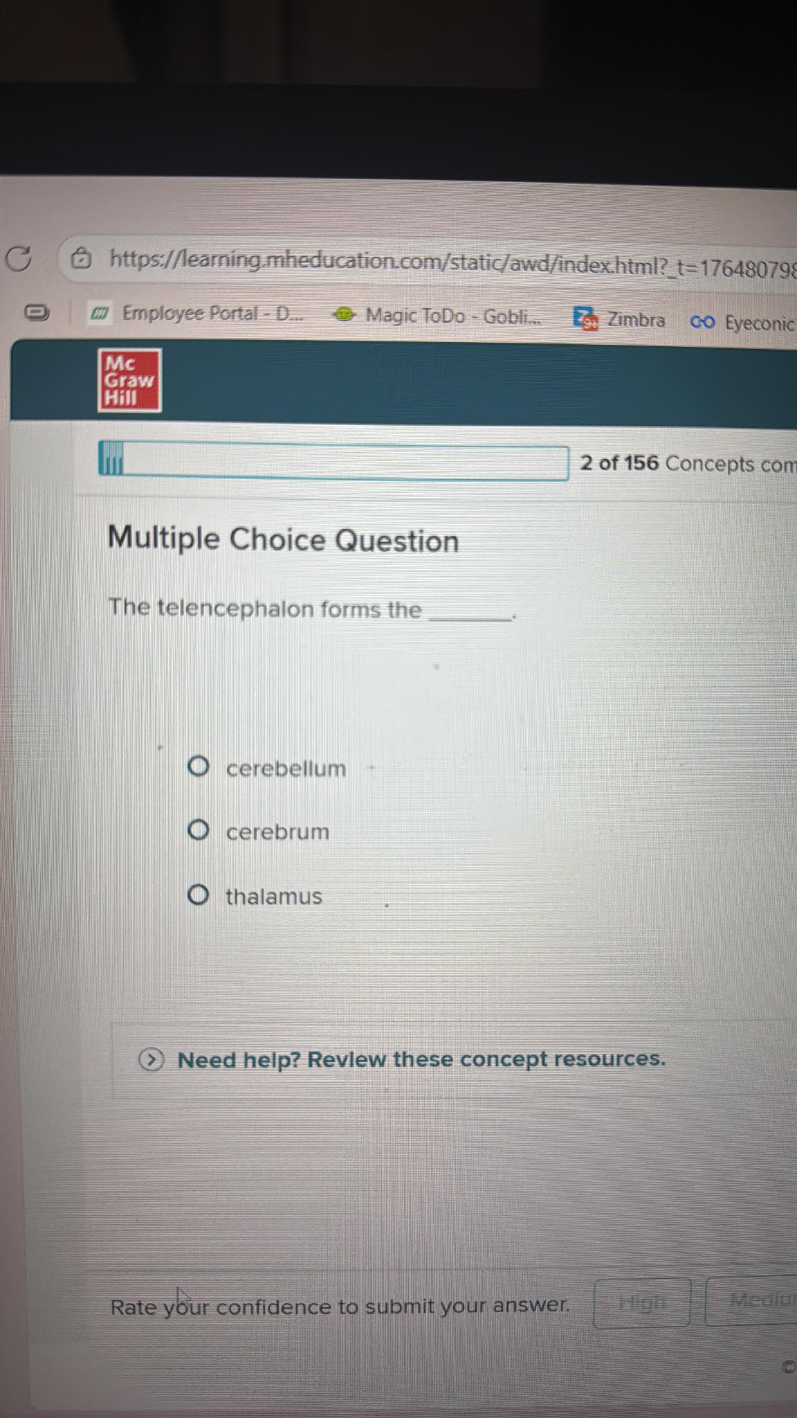 Multiple Choice Question The telencephalon | StudyX