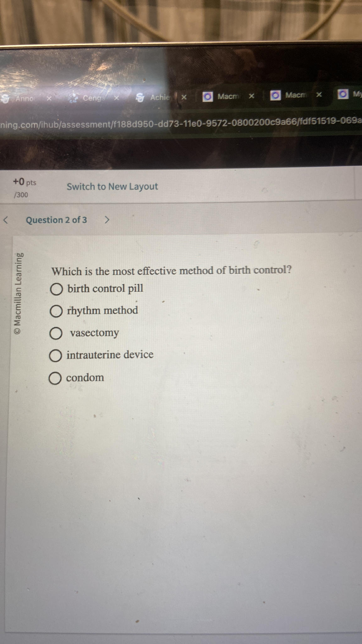 Which is the most effective method of birth | StudyX