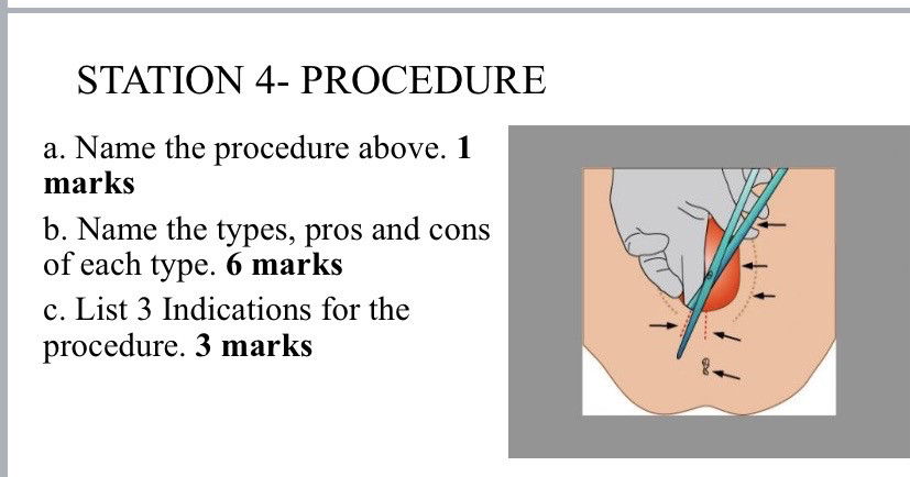 a. Name the procedure above. 1 marks b. | StudyX