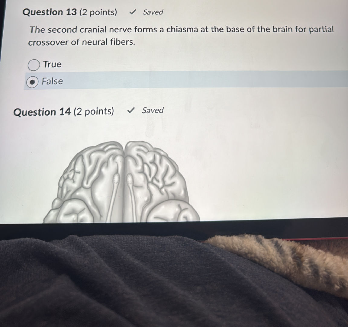 The second cranial nerve forms a chiasma at | StudyX