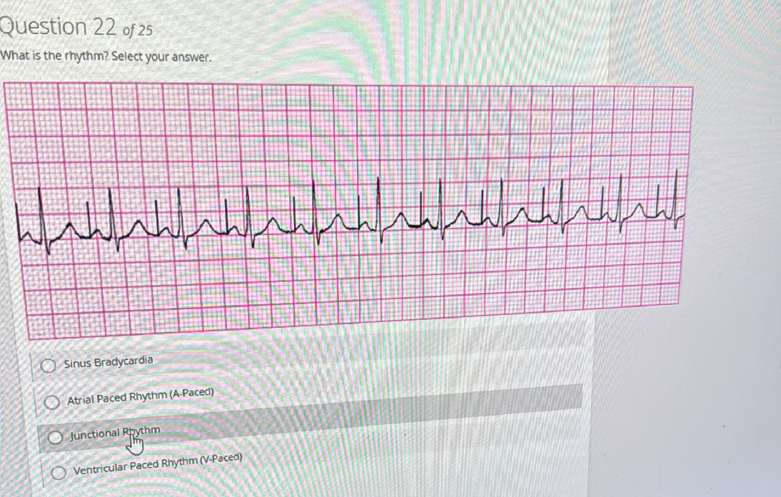 What is the rhythm? Select your answer. | StudyX