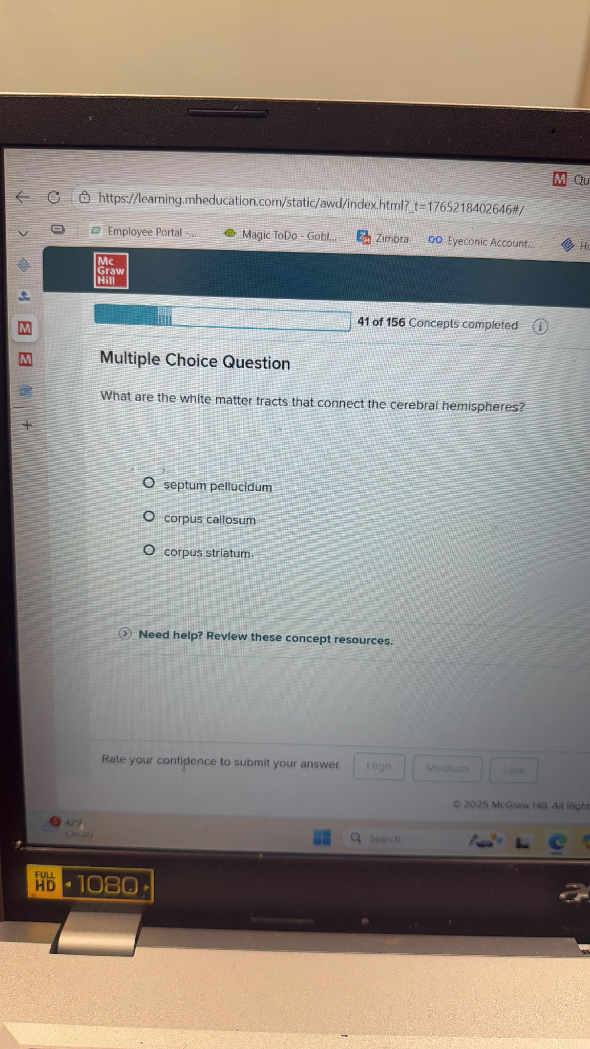 Multiple Choice Question What are the white | StudyX