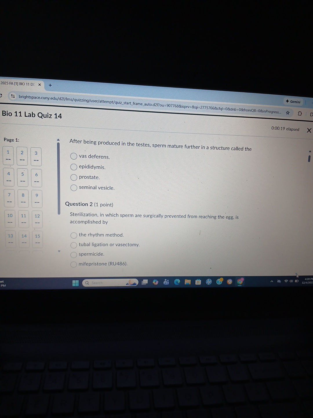 After being produced in the testes, sperm | StudyX