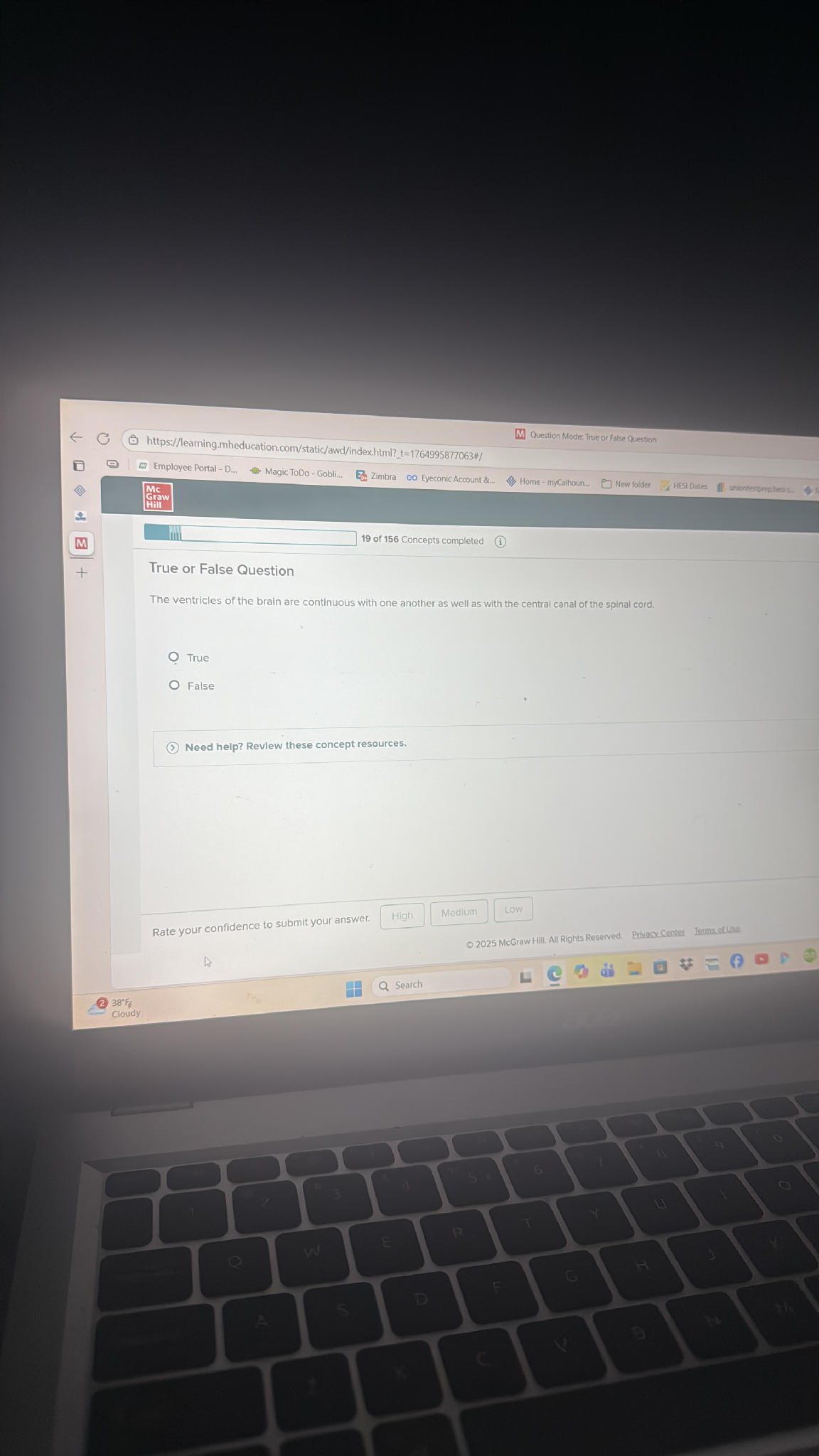 True or False Question The ventricles of | StudyX