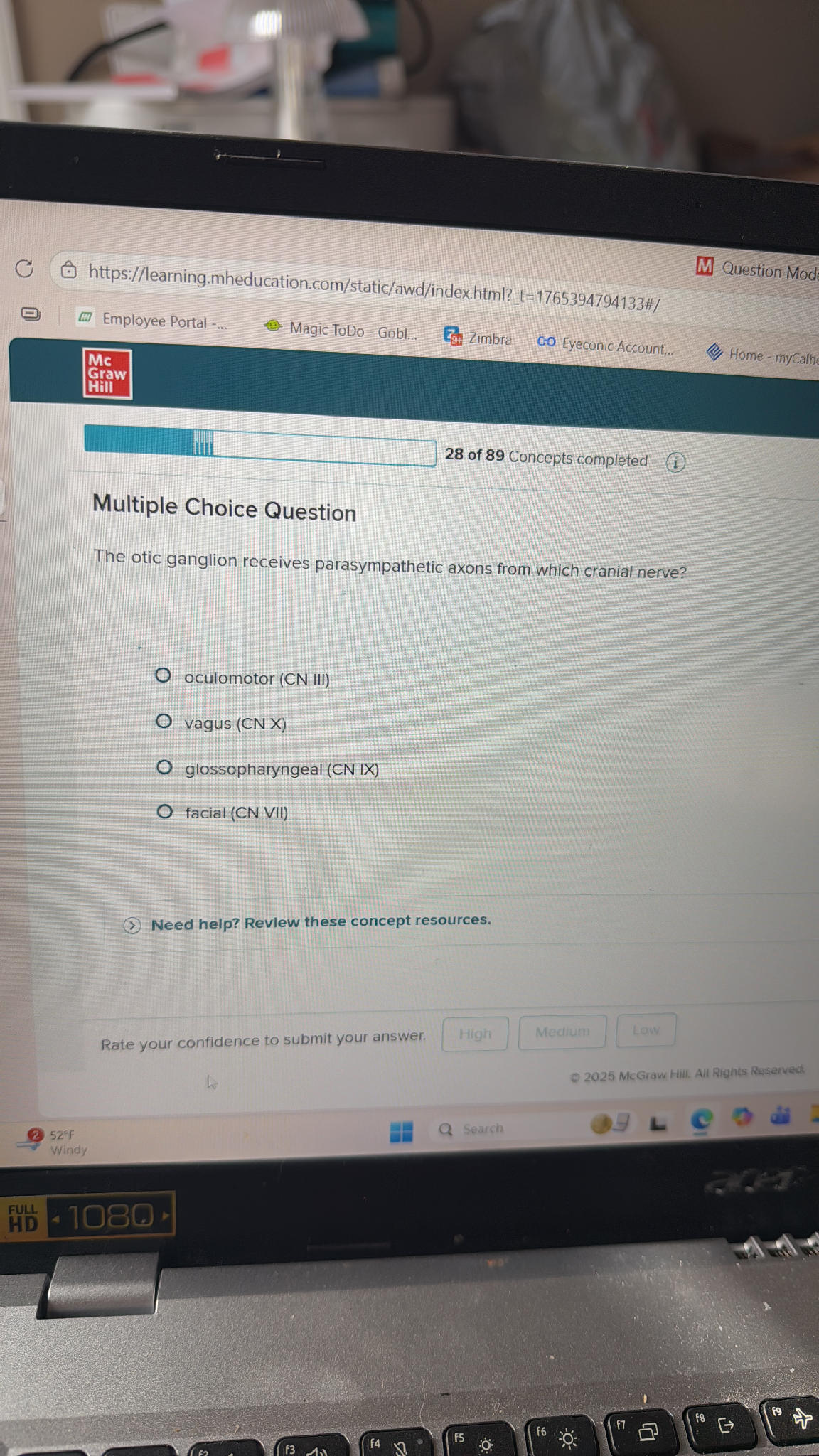 Multiple Choice Question The otic ganglion | StudyX