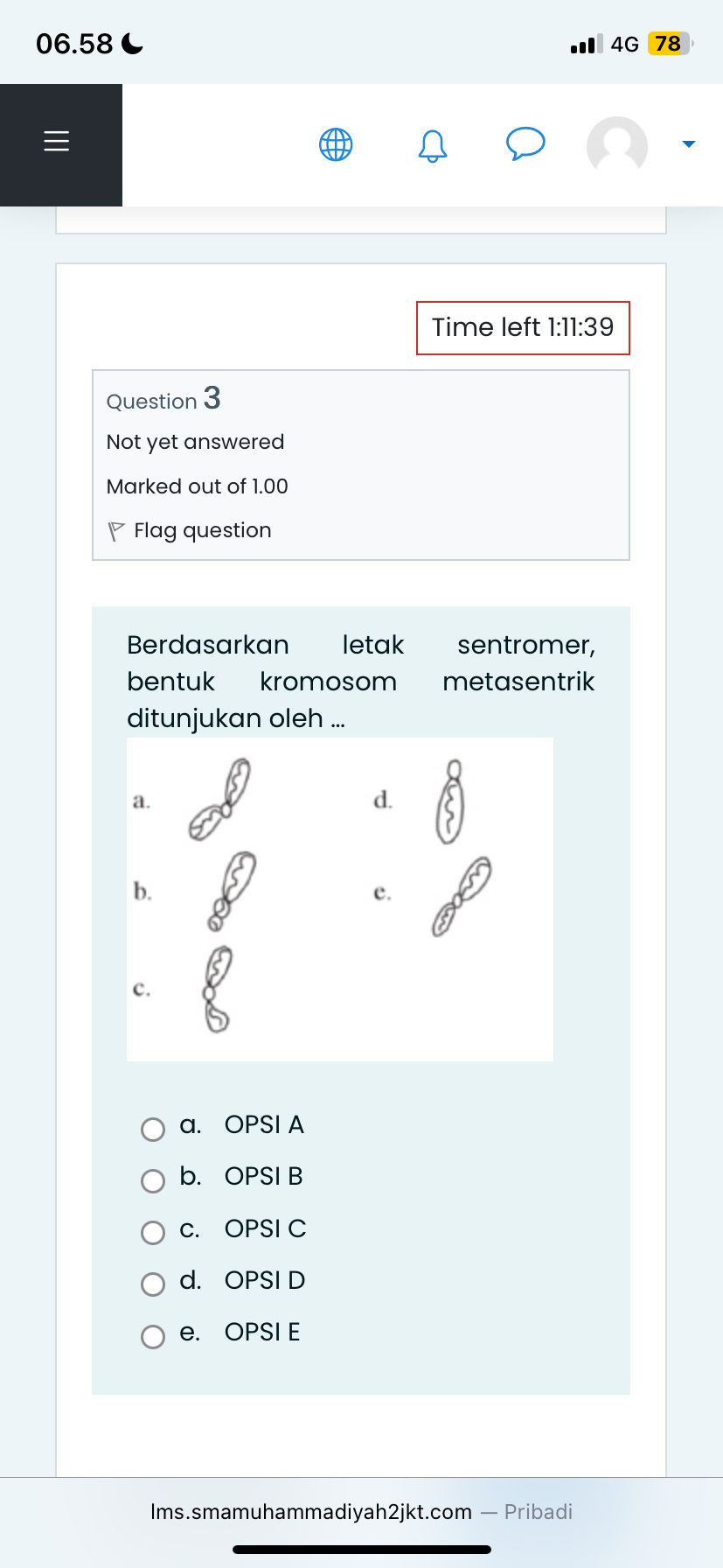 Berdasarkan letak sentromer, bentuk kromosom | StudyX