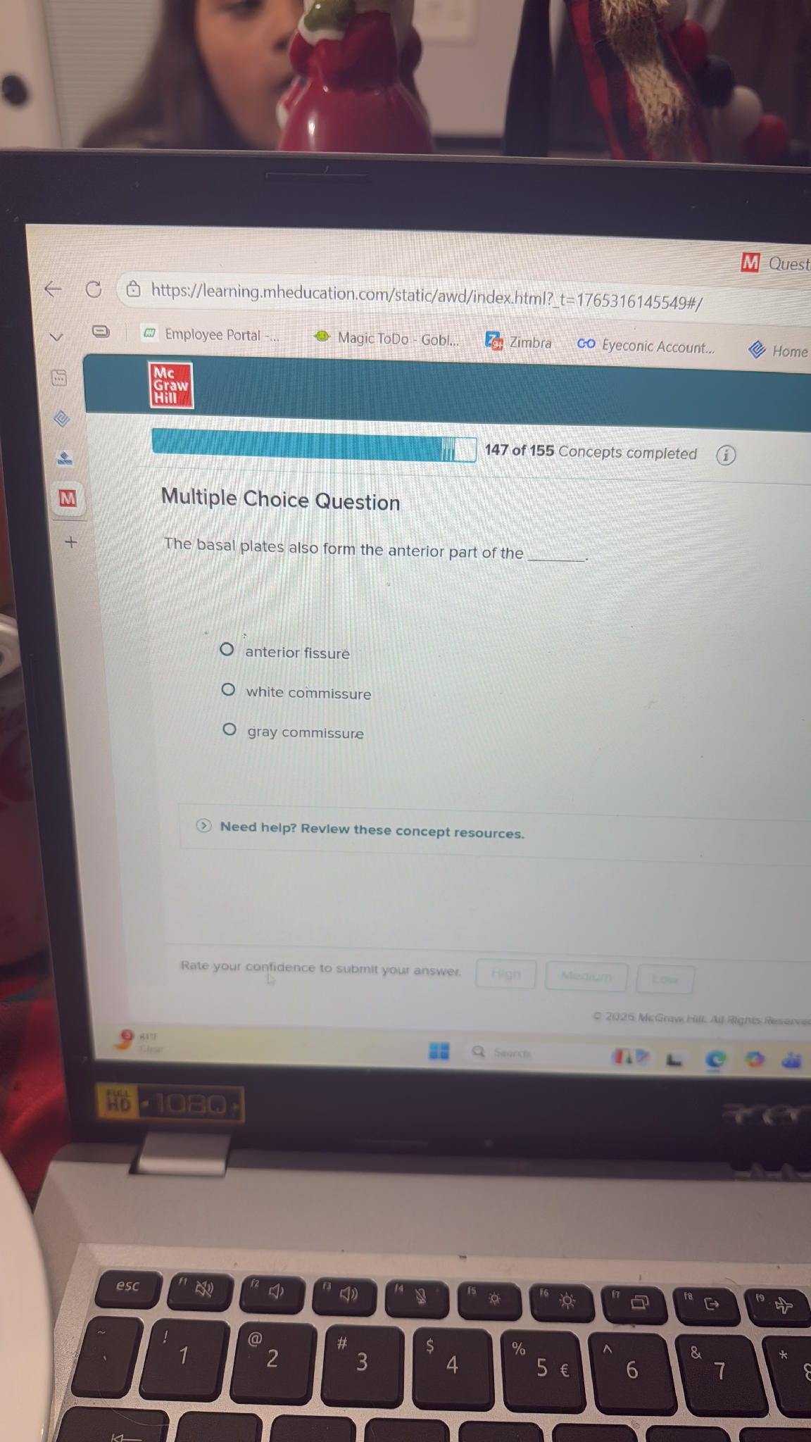 Multiple Choice Question The basal plates | StudyX