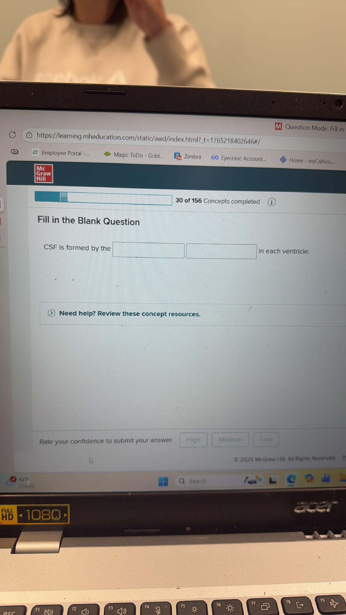 CSF is formed by the [BLANK 1] [BLANK 2] in | StudyX