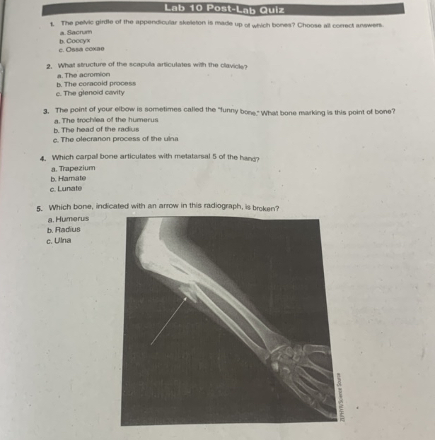 Lab 10 Post-Lab Quiz 1 The pelvic girdle of | StudyX