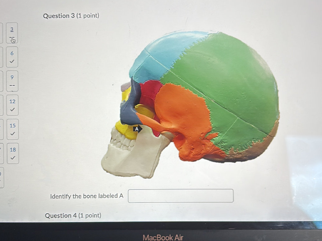 Question 3 (1 point) Identify the bone | StudyX
