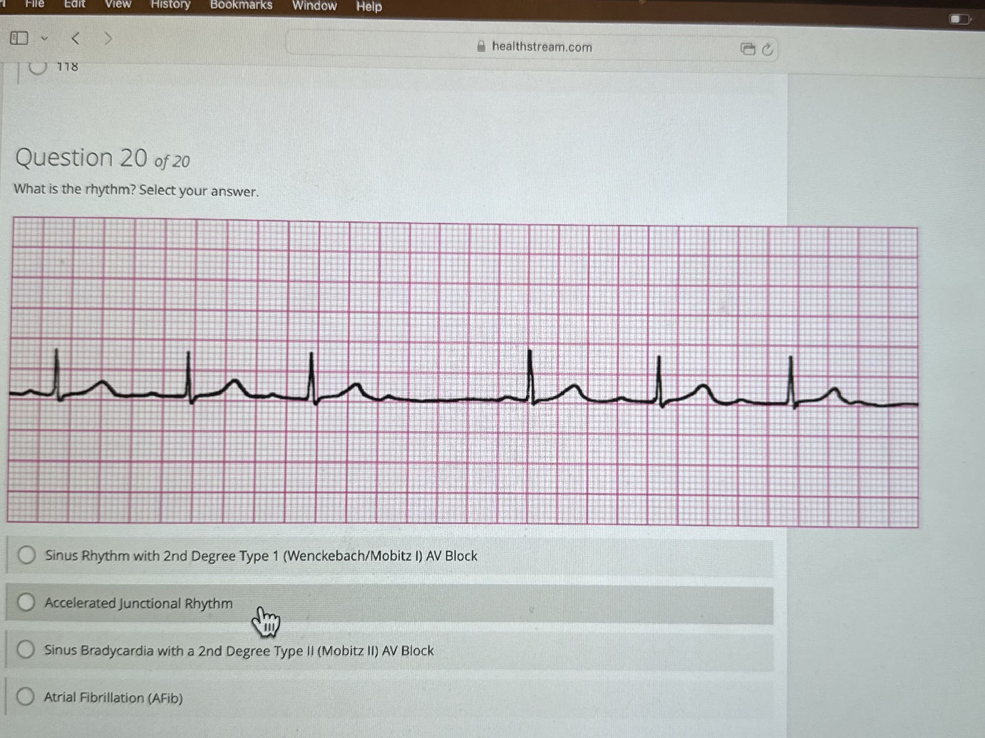 What is the rhythm? Select your answer. | StudyX