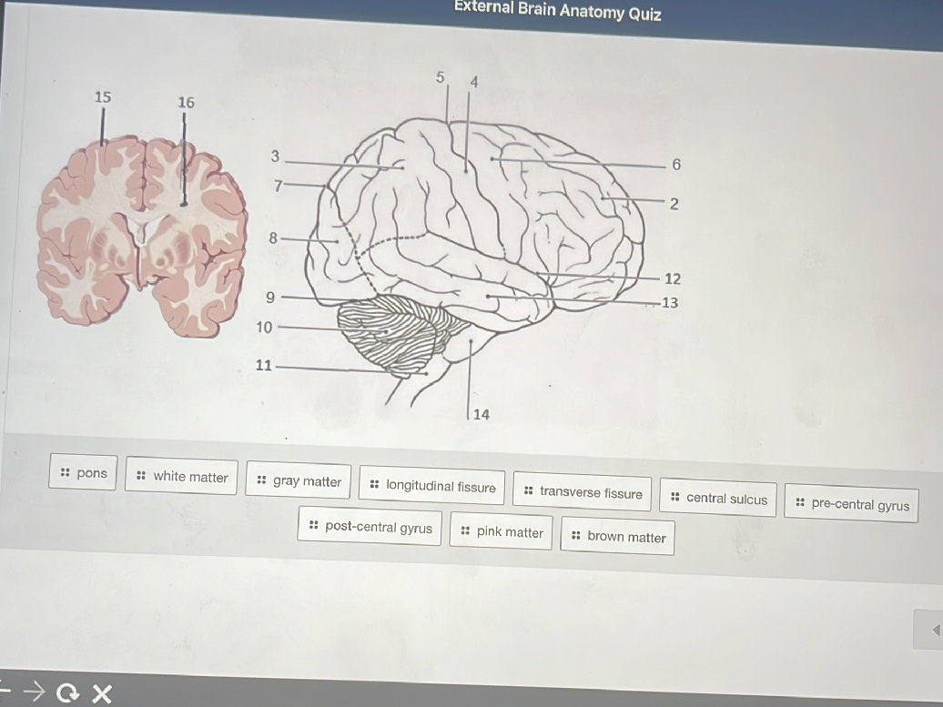 External Brain Anatomy Quiz [Image of a | StudyX
