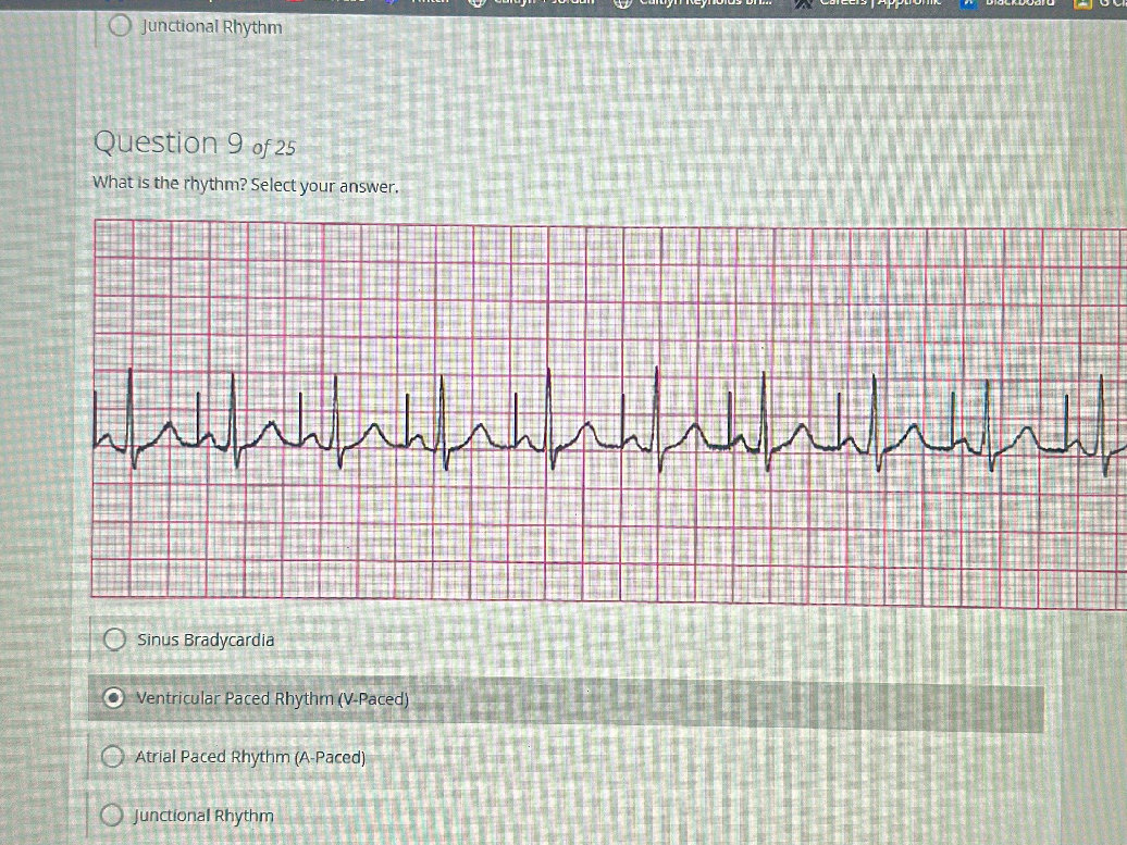 Question 9 of 25 What is the rhythm? Select | StudyX