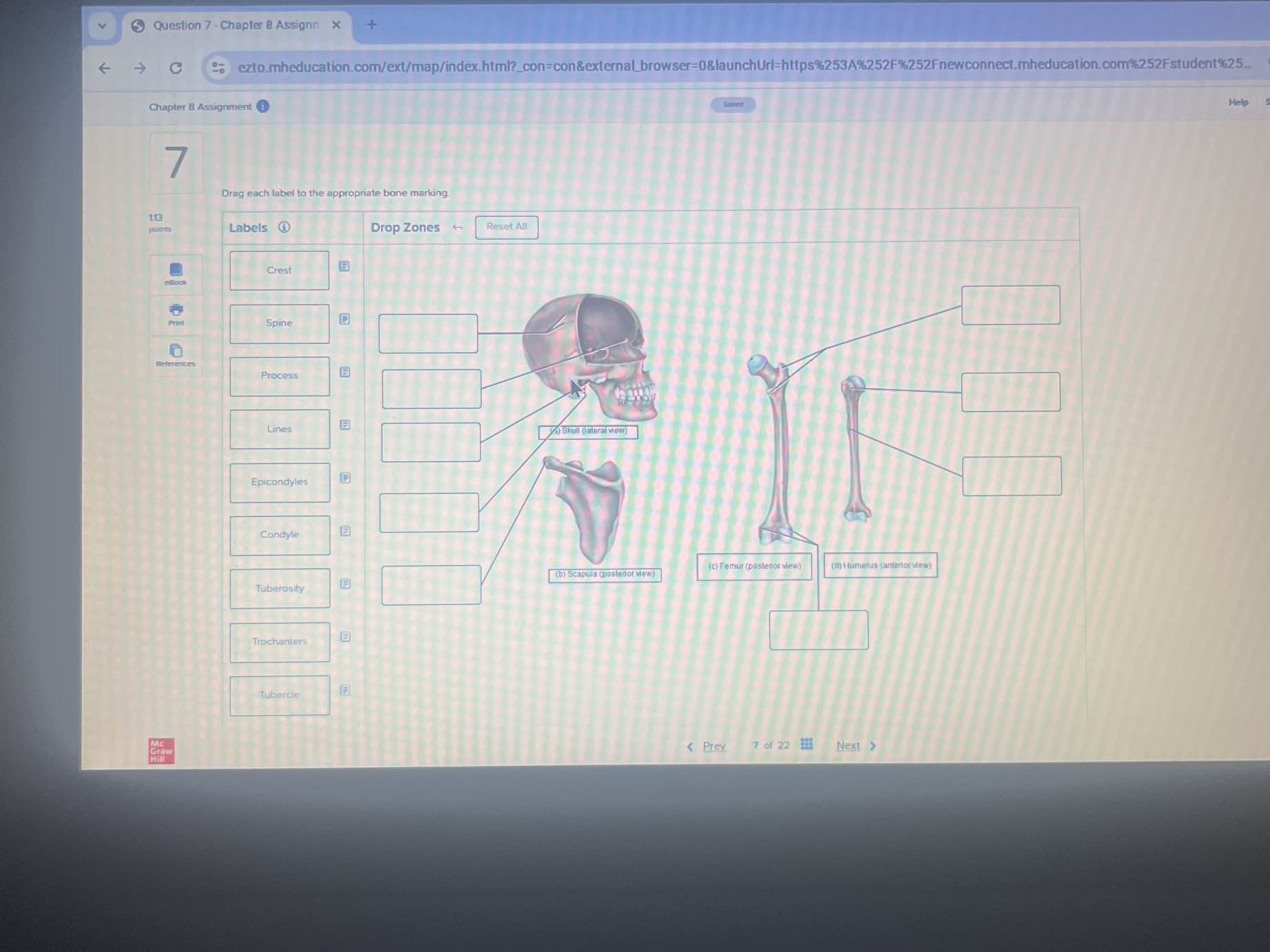 Drag each label to the appropriate bone | StudyX