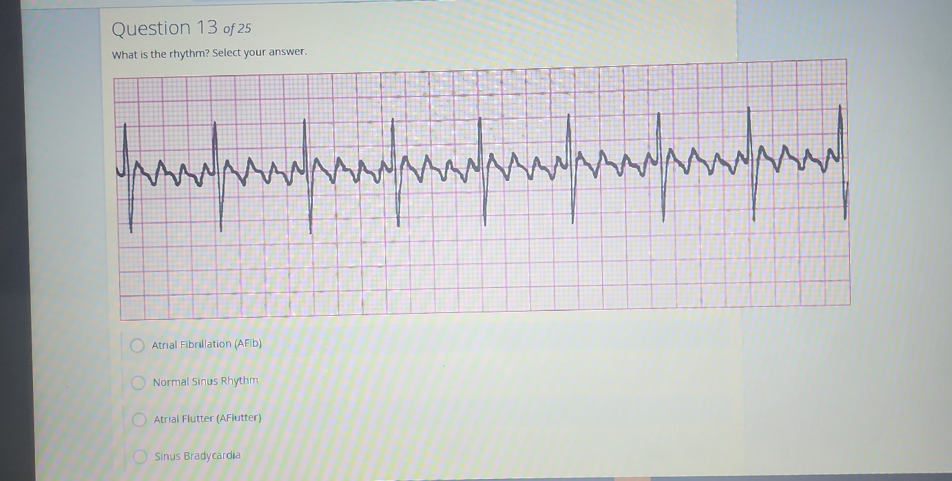 What is the rhythm? Select your answer. | StudyX
