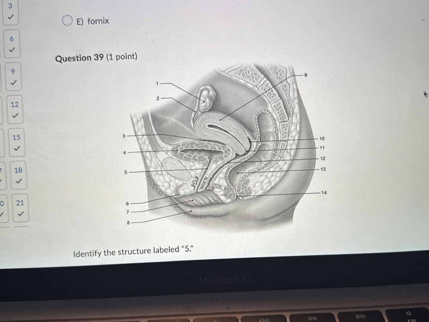 Question 39 (1 point) Identify the | StudyX