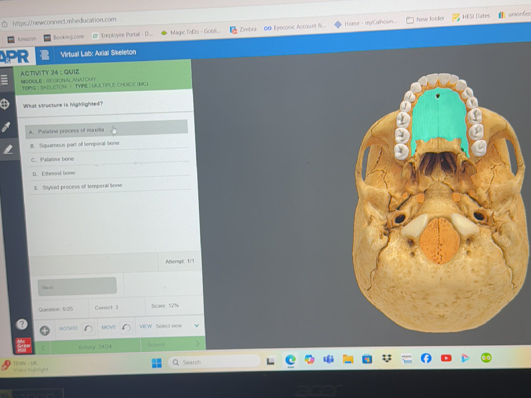 What structure is highlighted? A. Palatine | StudyX