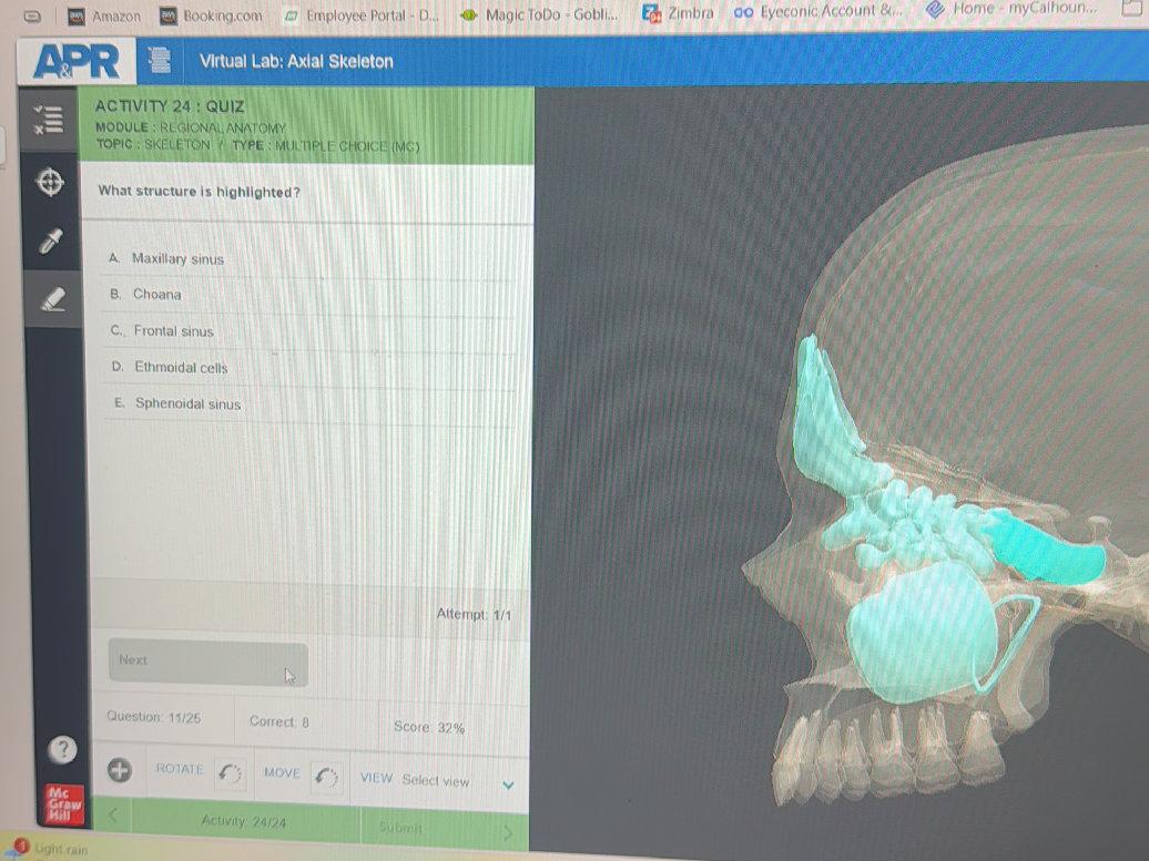 What structure is highlighted? A. Maxillary | StudyX