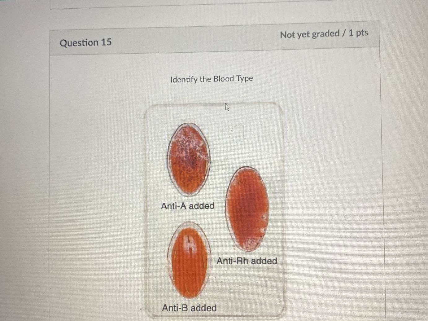 Identify the Blood Type [Image shows three | StudyX