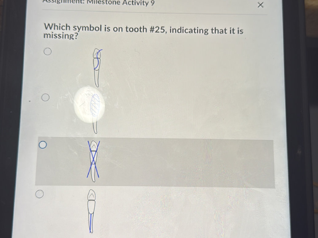 Which symbol is on tooth #25, indicating | StudyX