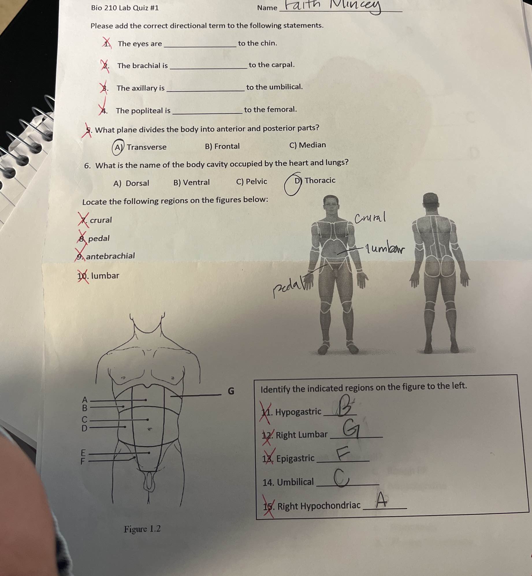 Please add the correct directional term to | StudyX