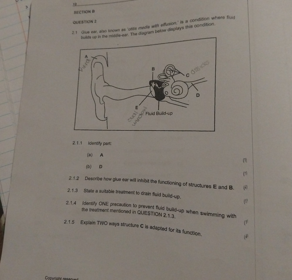 SECTION B QUESTION 2 2.1 Glue ear, also | StudyX