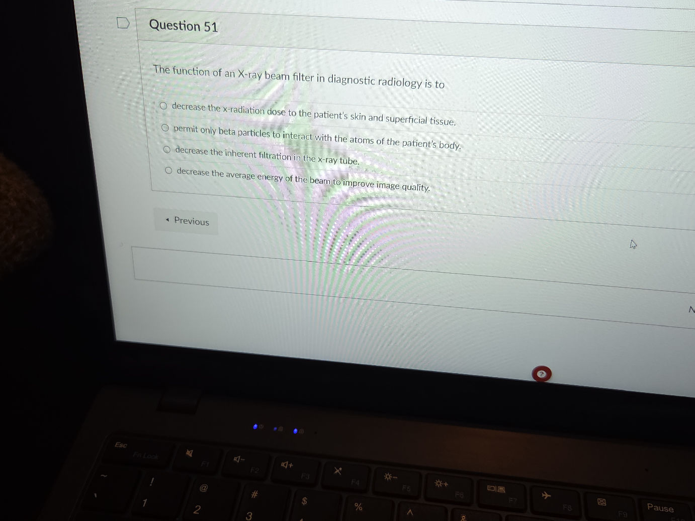 The function of an X-ray beam filter in | StudyX