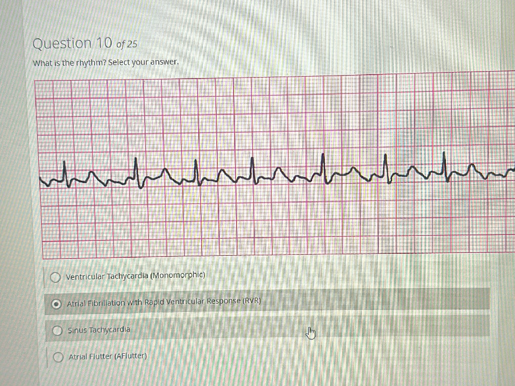 What is the rhythm? Select your answer. | StudyX