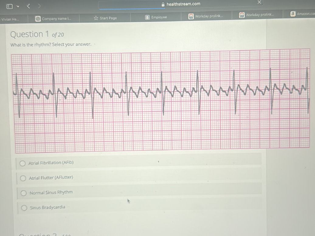 What is the rhythm? Select your answer. | StudyX