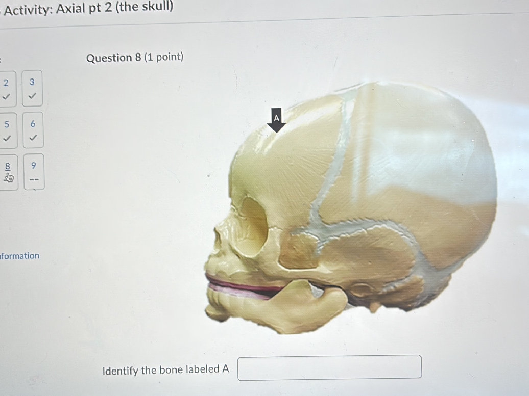 Question 8 (1 point) Identify the bone | StudyX