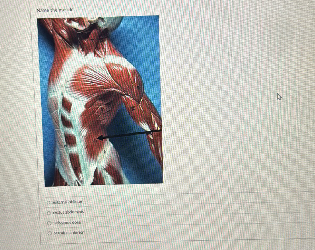 Name the muscle: (Image shows a muscle | StudyX