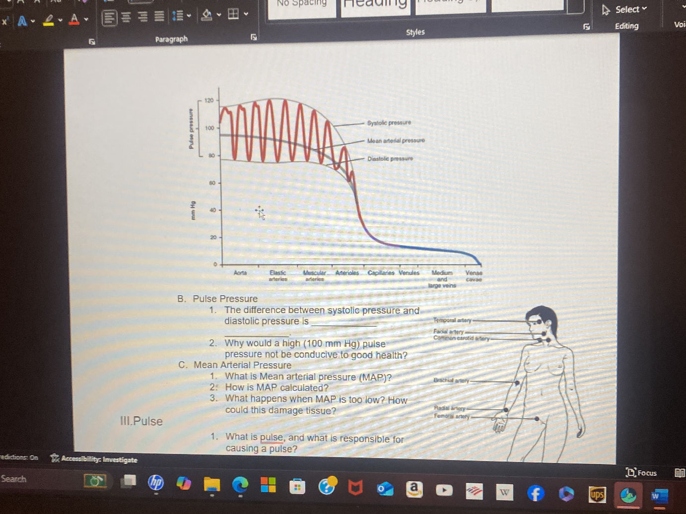 B. Pulse Pressure 1. The difference between