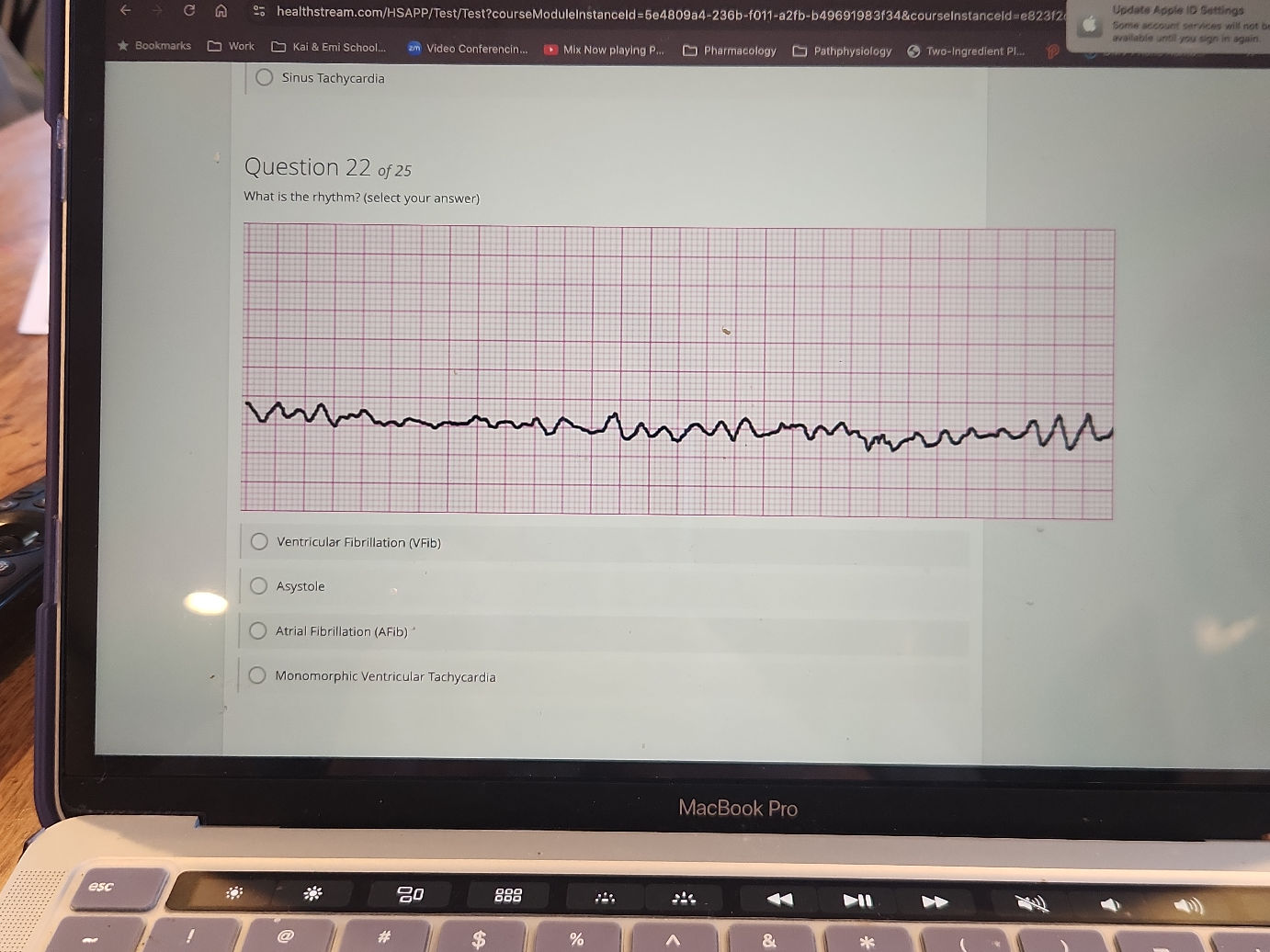 Question 22 of 25 What is the rhythm? | StudyX